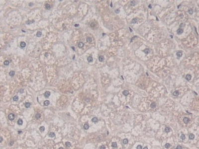 Monoclonal Antibody to Procollagen III N-Terminal Propeptide (PIIINP ...