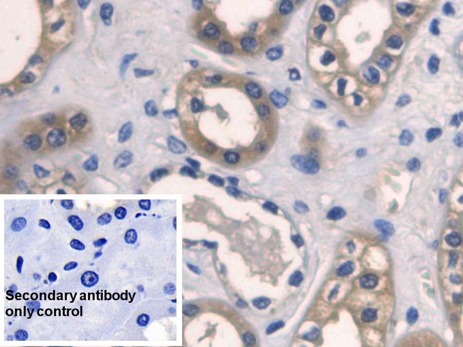 Monoclonal Antibody to Procollagen I N-Terminal Propeptide (PINP ...