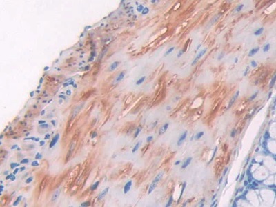 Polyclonal Antibody to Collagen Type II Alpha 1 (COL2a1) | PAD194Mu01 ...