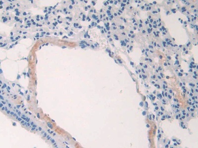 Polyclonal Antibody to Collagen Type II Alpha 1 (COL2a1) | PAD194Mu01 ...